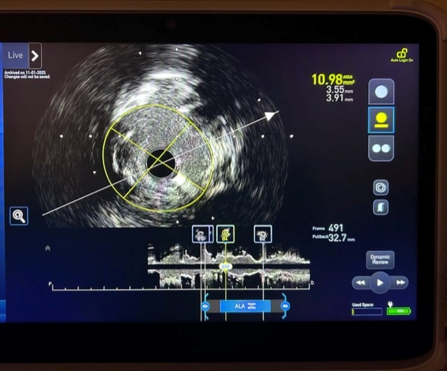 Memorial Hermann Is First to Use New Integrated Technology for Heart ...